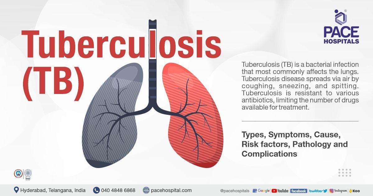 Fact Check: Is TB curable? | TruthOrFake Blog
