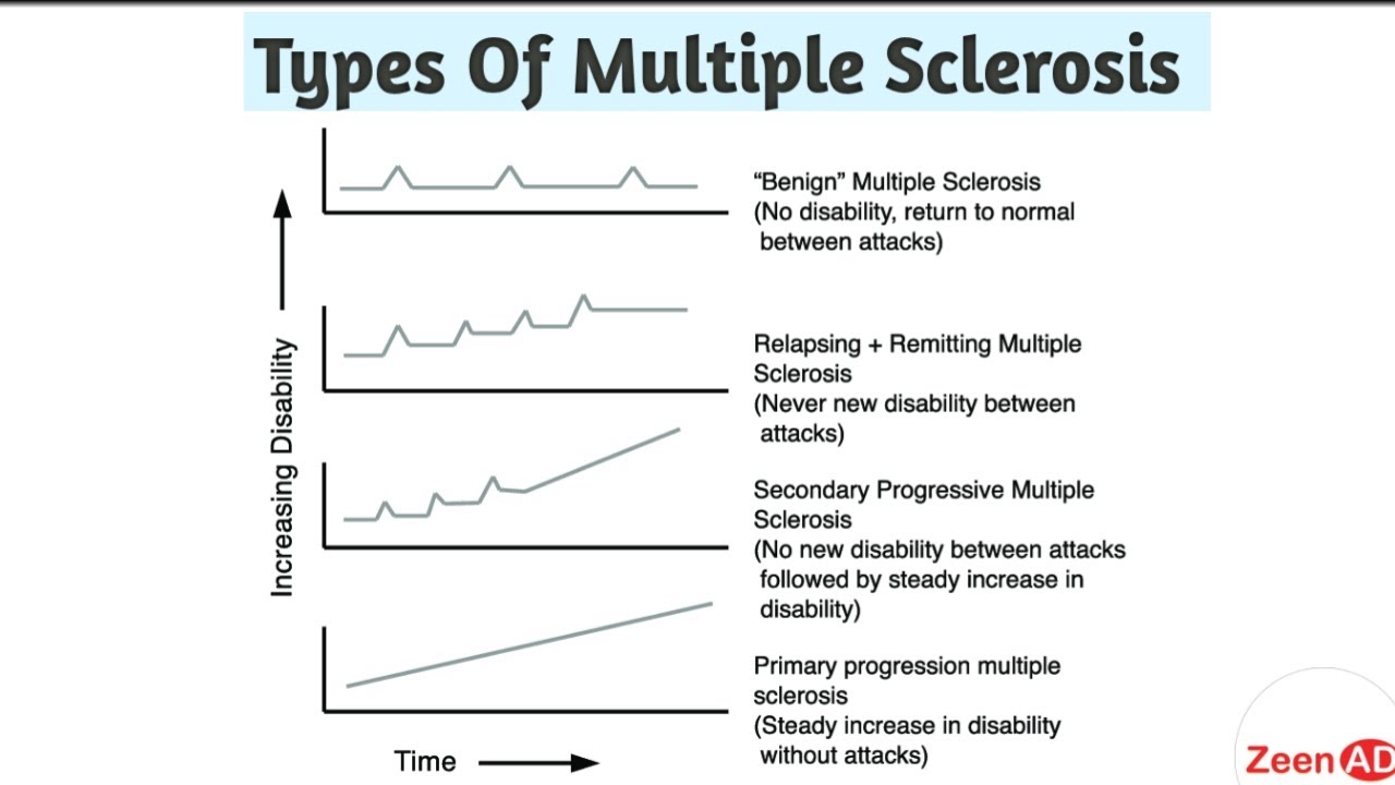 Fact Check: Is multiple sclerosis (MS) a genetic condition ...
