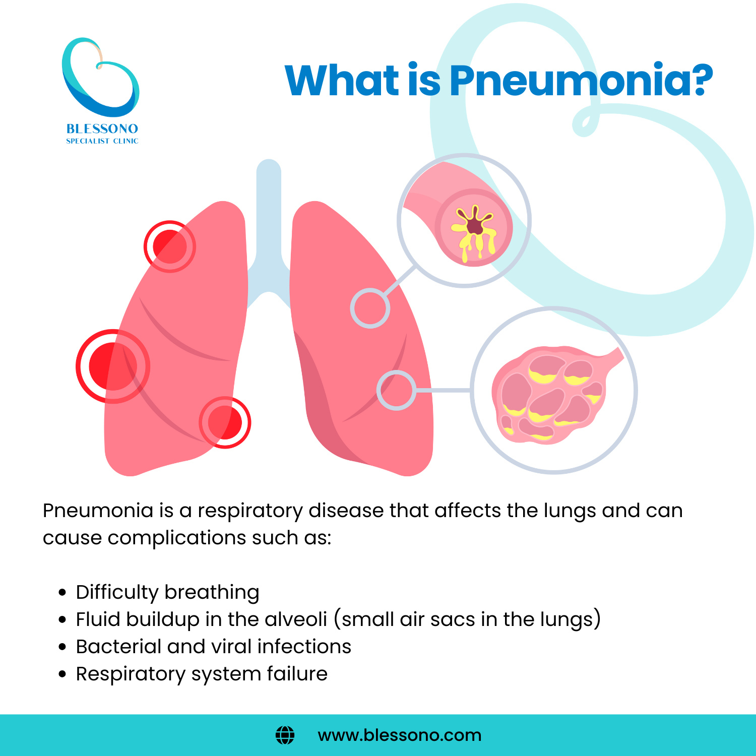 Fact Check: Is pneumonia curable? | TruthOrFake Blog
